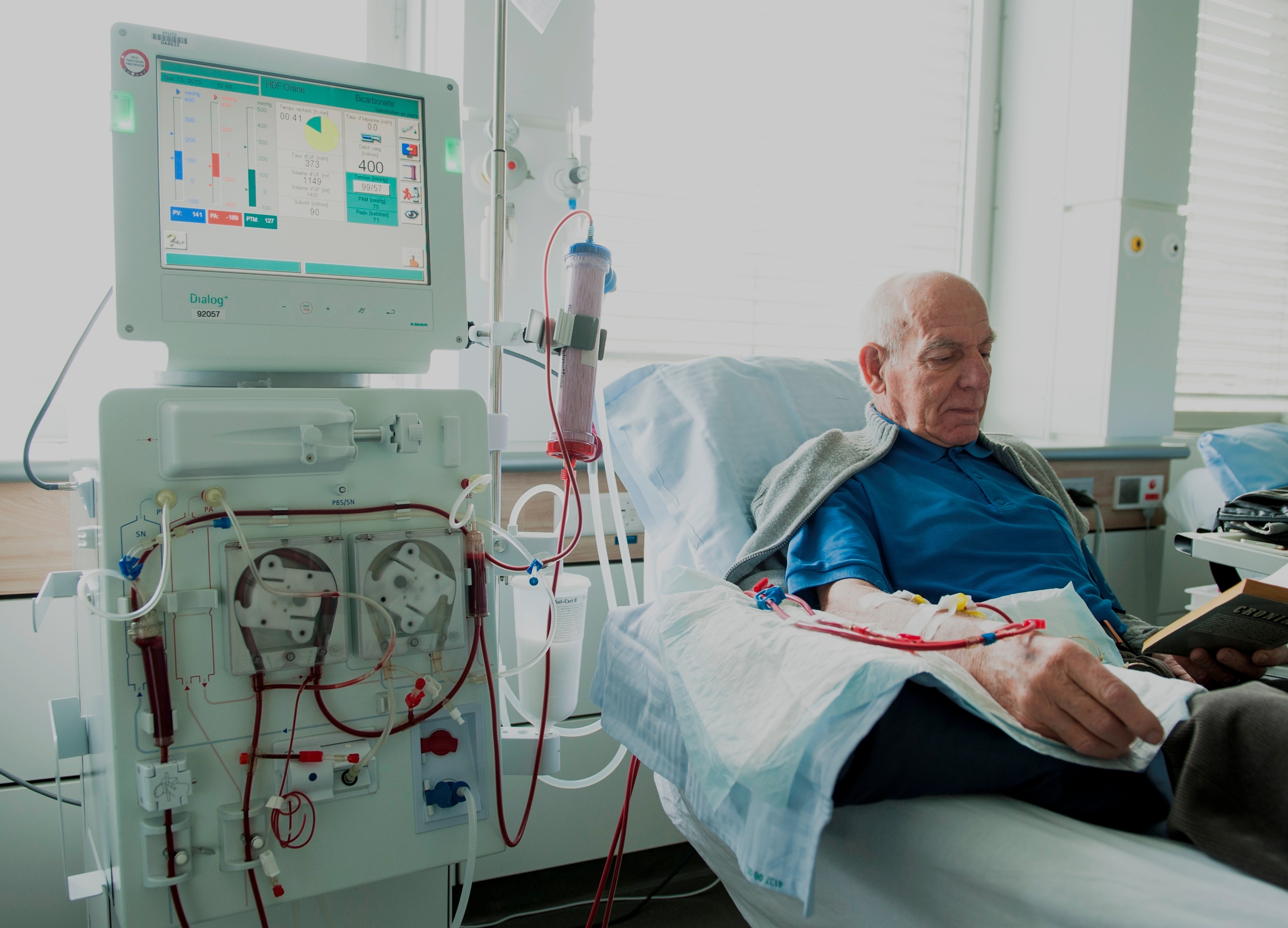 Hémodialyse, la vitesse de la pompe à sang – NEPHROHUG